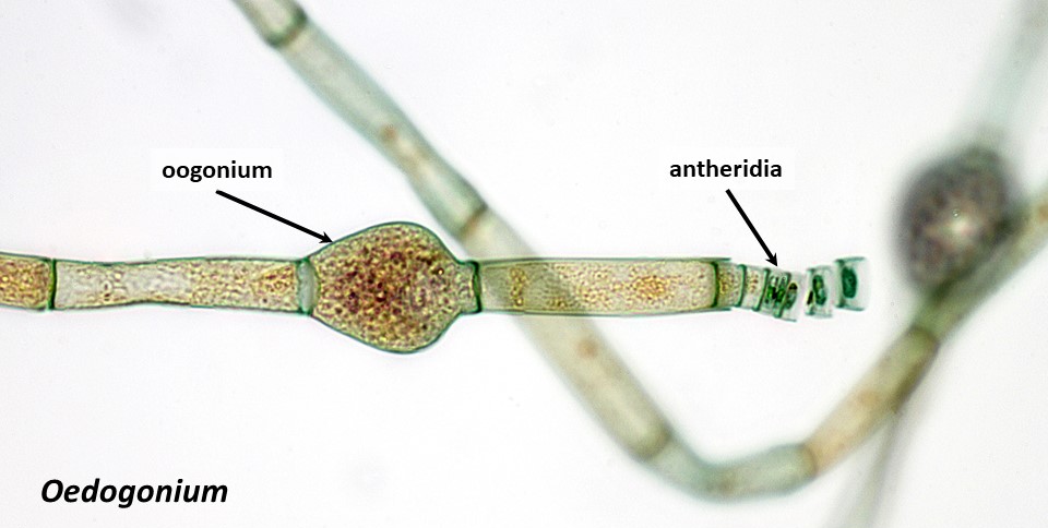 Oedogonium Under Microscope Labeled